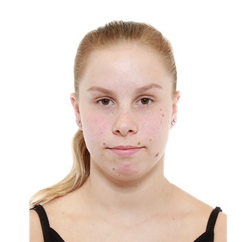 Ronja RUNDGREN | Results | World Aquatics Official